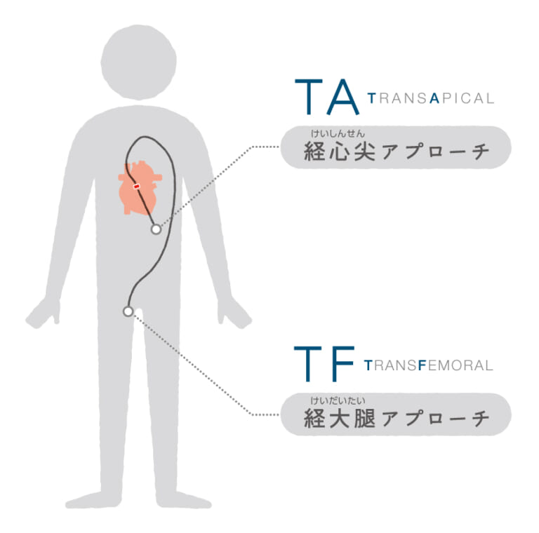 ご紹介くださる先生方へ - 徳島大学大学院 医歯薬学研究部 心臓血管外科分野
